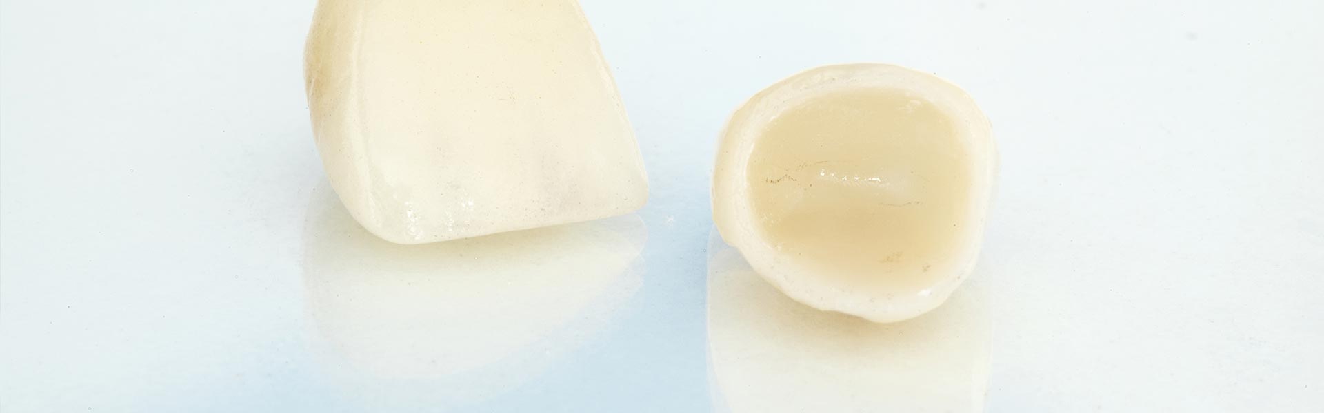 Metal Free - Elite Dental Lab