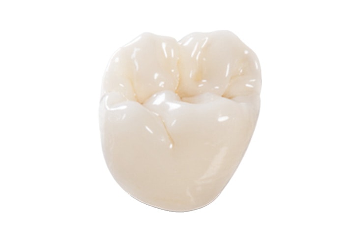 Temporary Crown - Elite Dental Lab