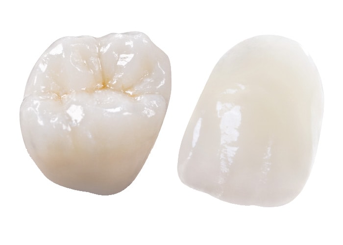 Fixed - Elite Dental Lab
