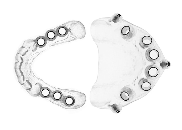 Surgical Guides - Elite Dental Lab